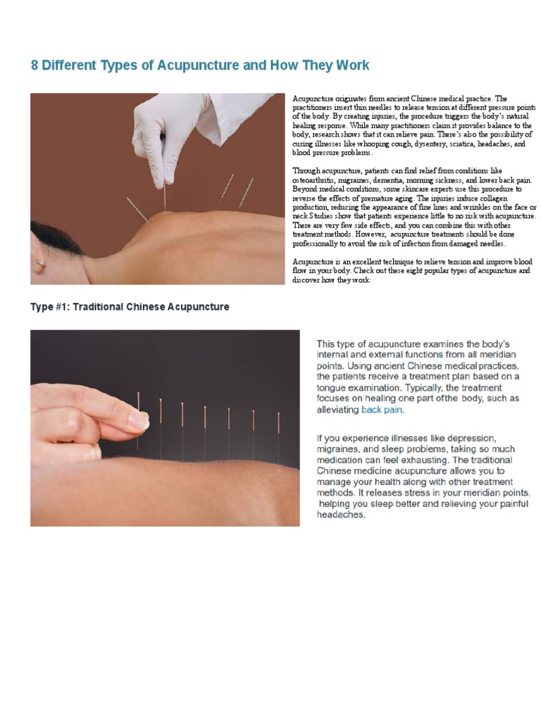 8 Different Types of Acupuncture and How They Work | PDF | Acupuncture ...
