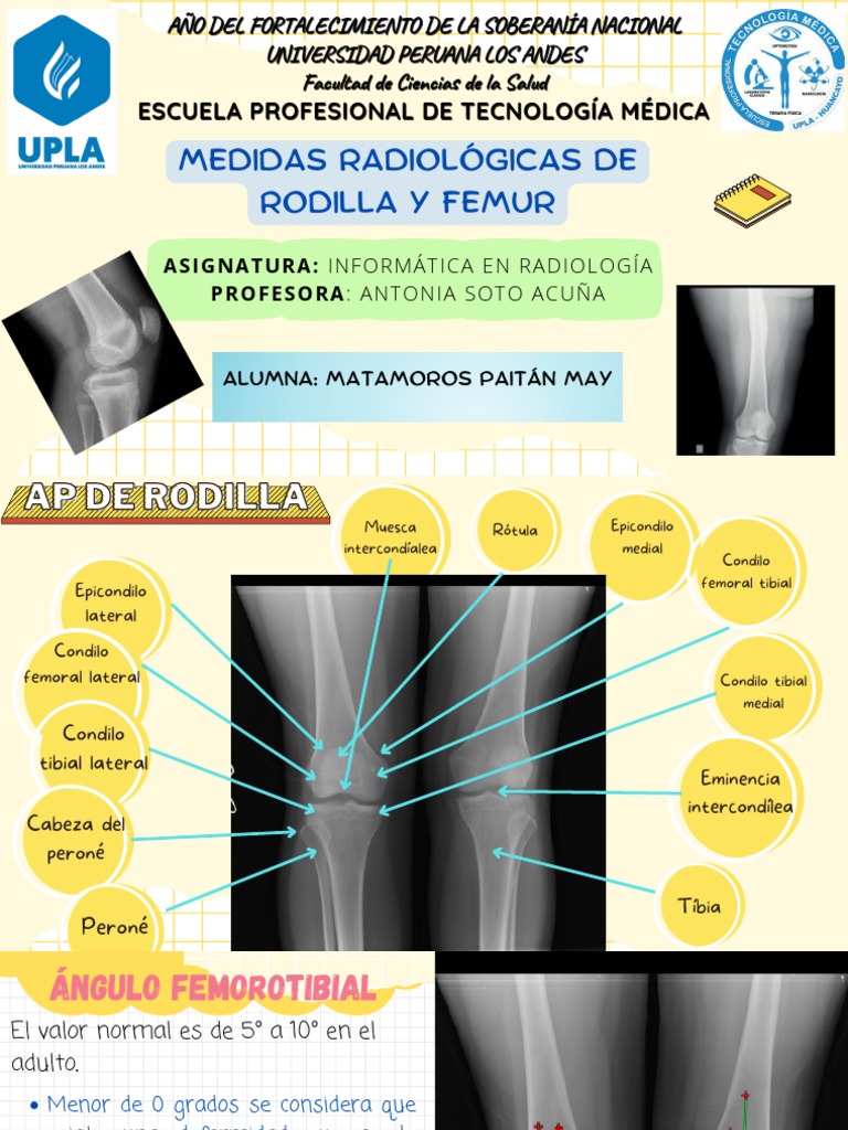 Medidas Radiológicas de Rodilla y Femur | PDF | Rodilla | Sistema ...