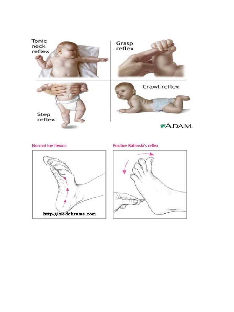 Newborn Reflexes | PDF