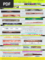 Teorías de Caries y Triada de Keyes | PDF | Las bacterias | Diente