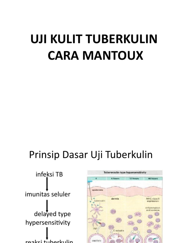 Praktek Uji Tuberkulin | PDF