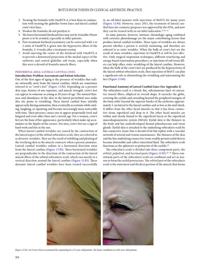 Aesthetic Botulinum Toxin Guide | PDF