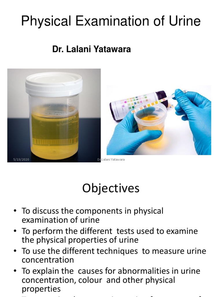 Physical Examination of Urine - Note 1-1 | PDF | Urine | Clinical Medicine