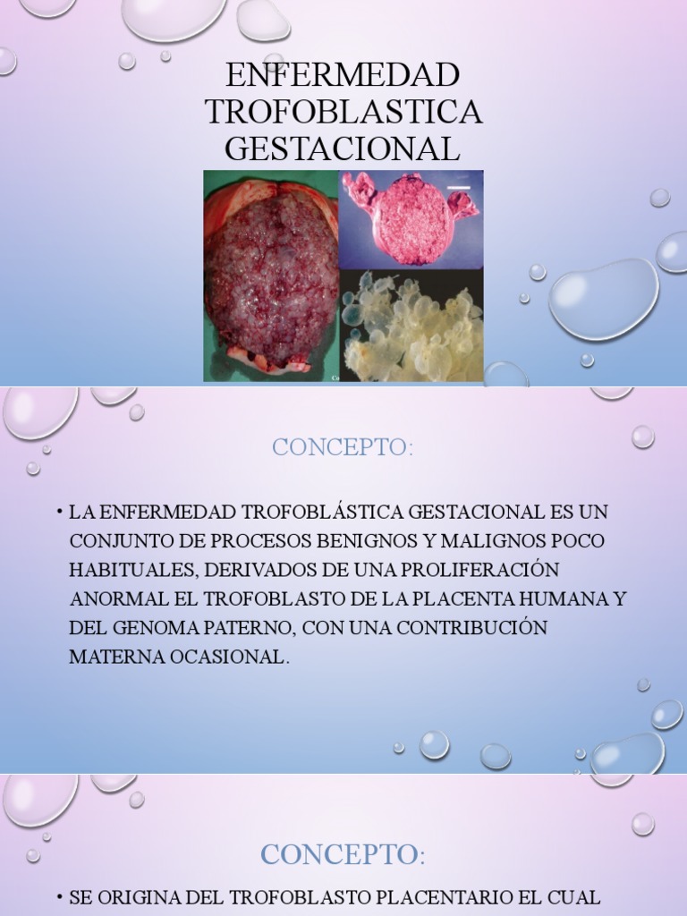 Enfermedad Trofoblastica Gestacional | PDF | Enfermedades y trastornos ...