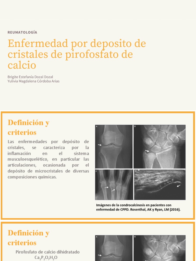 Cristales de Pirofosfato | PDF | Sistema complementario | Linfocitos