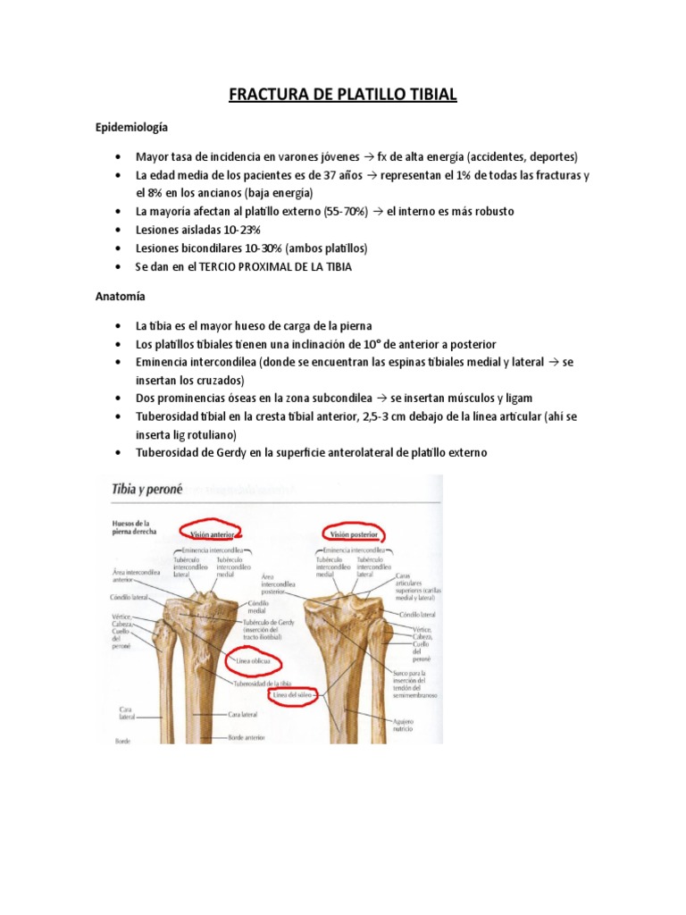 6 - Fractura de Platillo Tibial | PDF | Rodilla | Sistema ...