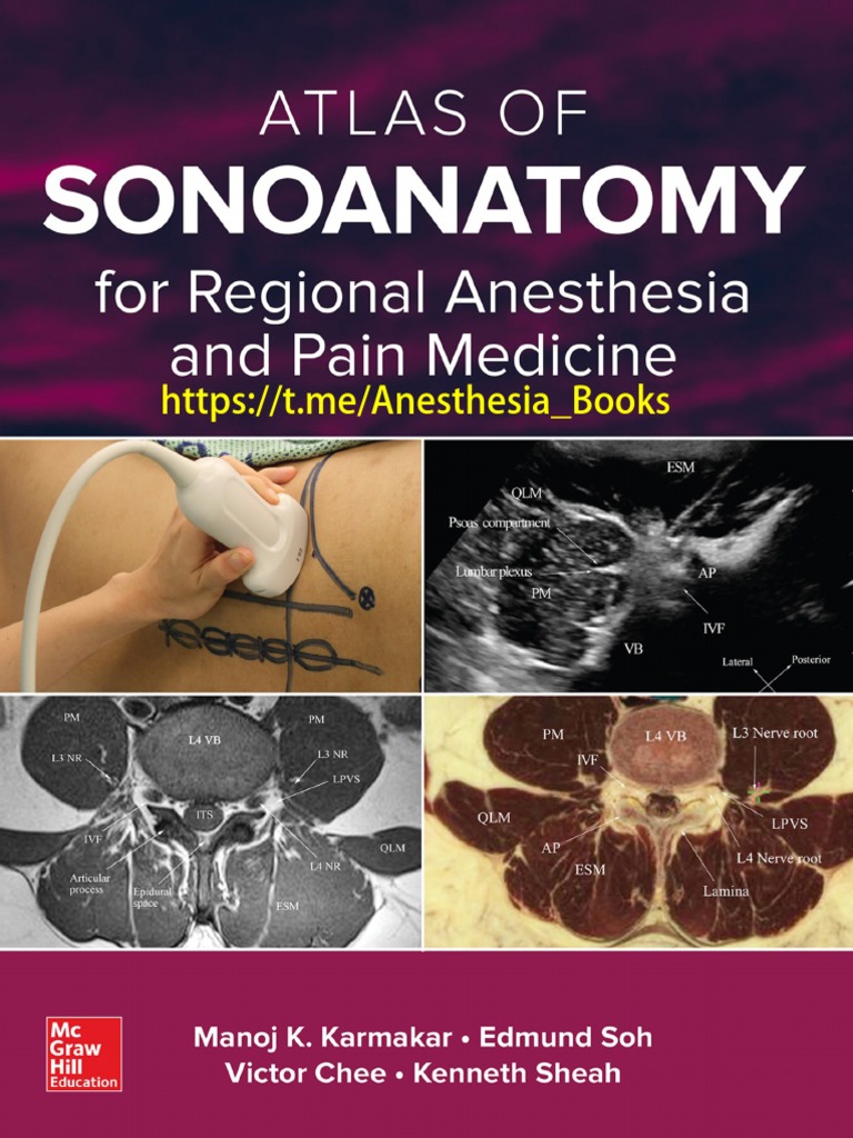 @anesthesia Books 2018 Atlas of | PDF | Medical Ultrasound | Medical ...