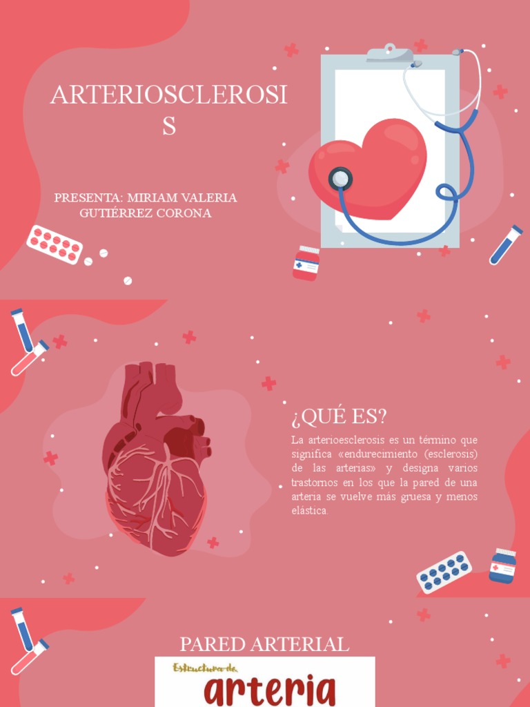 Arteriosclerosis: Causas y Tratamiento | PDF | Macrófago | Hipertensión