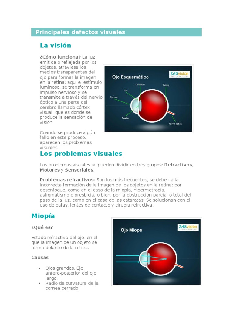 Principales Defectos Visuales | PDF | Ojo humano | Percepción visual