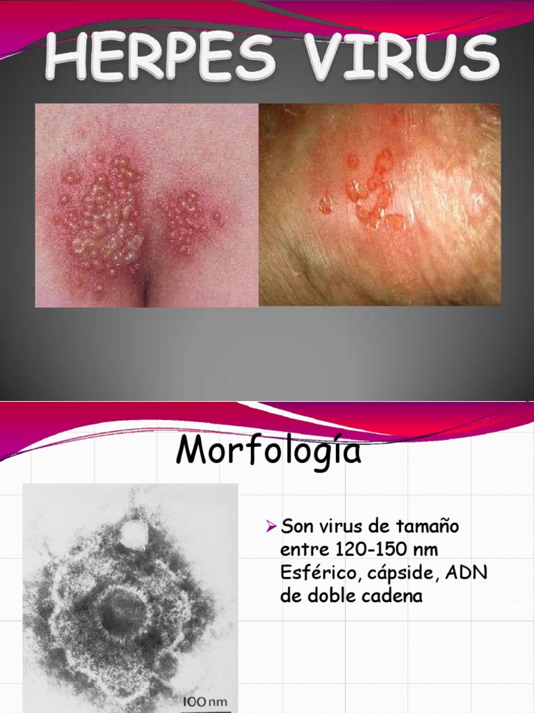 Herpes Virus Tipo 1 y 2 | PDF