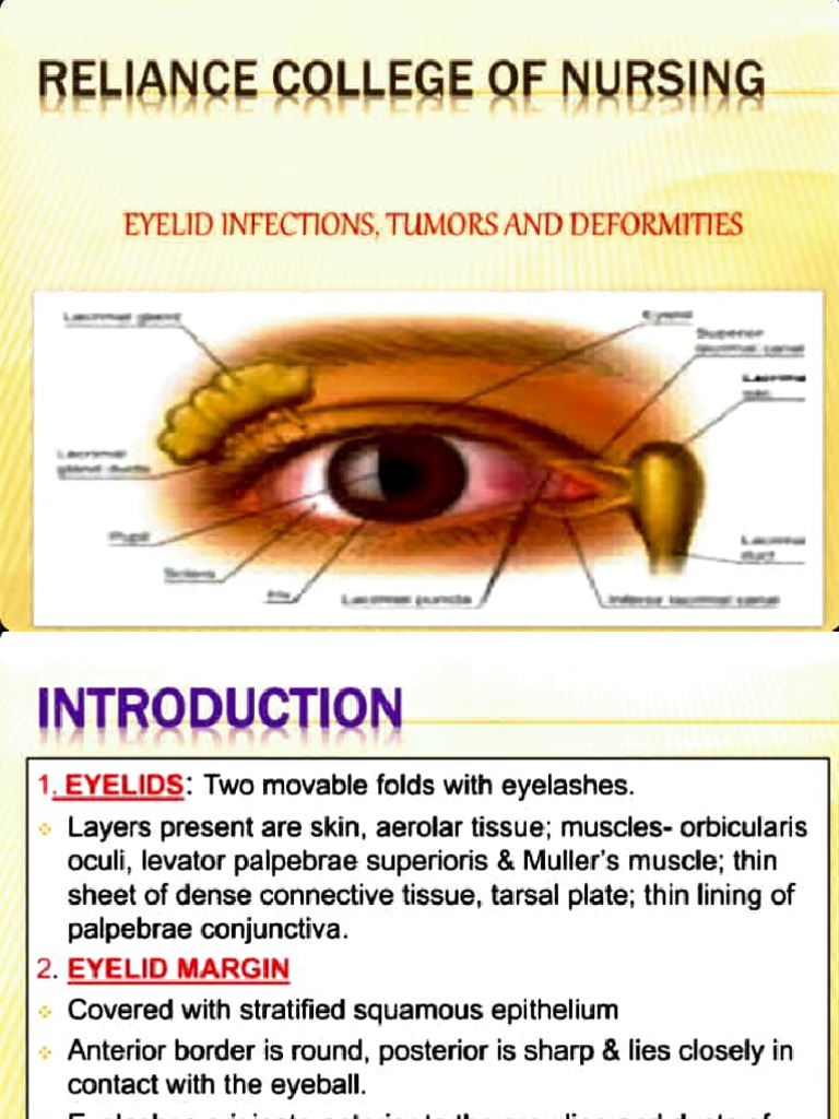 Eye Lid Infection | PDF