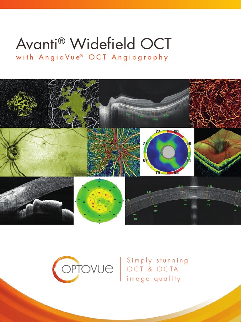Brochure OPTOVUE XRAvanti | PDF | Retina | Glaucoma
