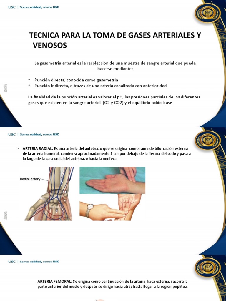 Tecnica para Toma de Gases Arteriales y Venosos | Descargar gratis PDF ...