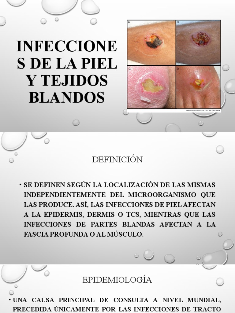 Infecciones de La Piel y Tejidos Blandos | PDF | Inflamación | Citocina