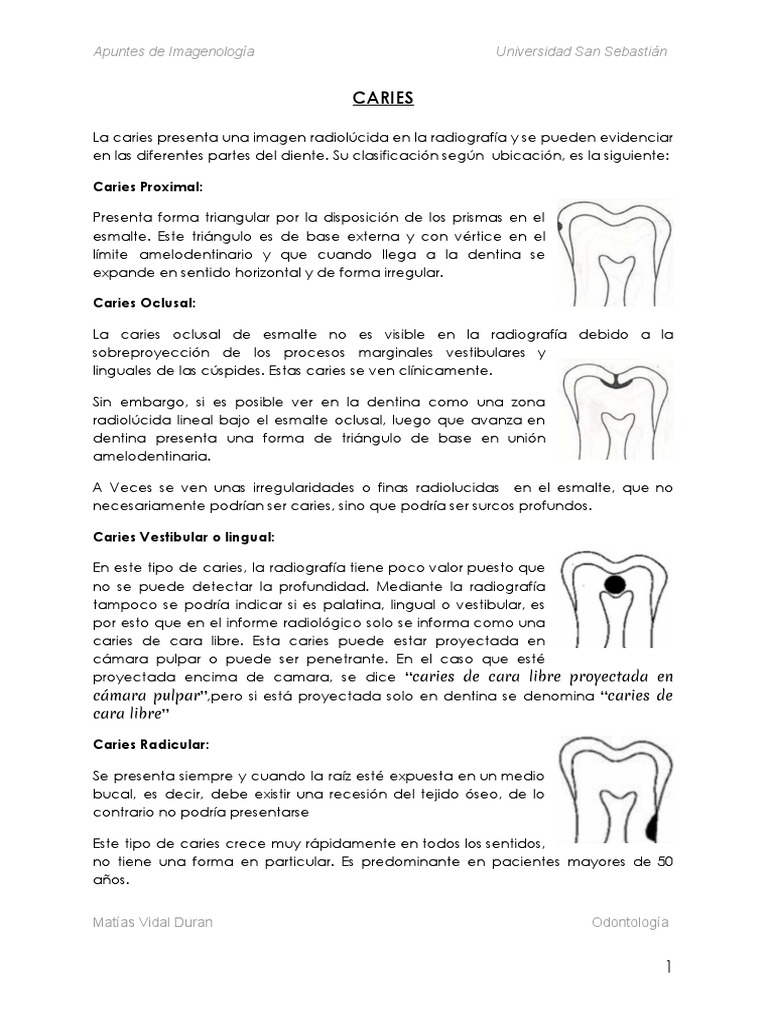 Caries Radiografia | PDF | Esmalte de dientes | Odontología