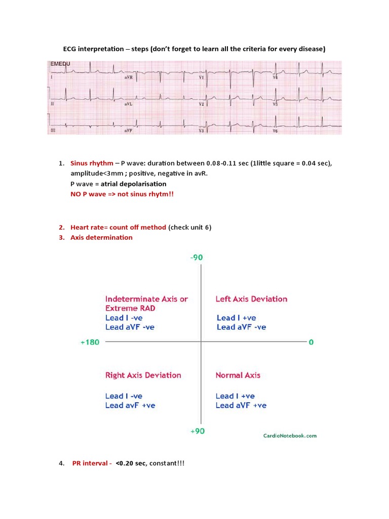 A Step-by-Step Guide to ECG Interpretation and Identification of Cardiac Dysrhythmias | PDF