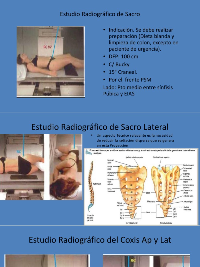 Columna Sacrocoxis y Columna Total | PDF | La columna vertebral ...