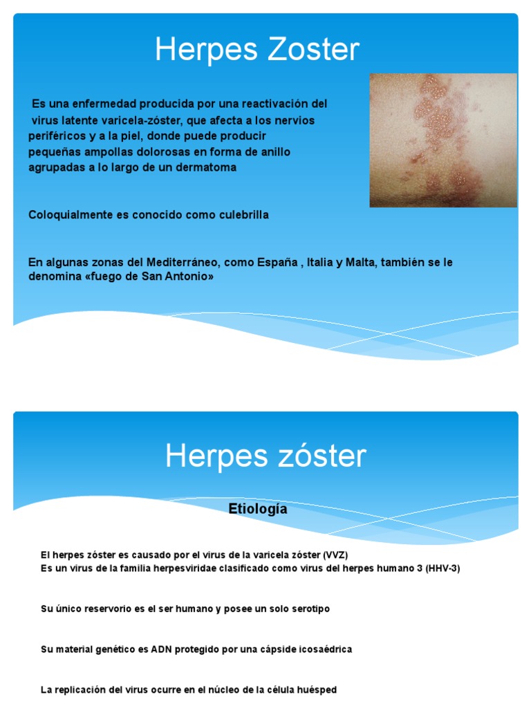 Herpes Zoster | PDF | Ciencias de la Salud | Medicina CLINICA