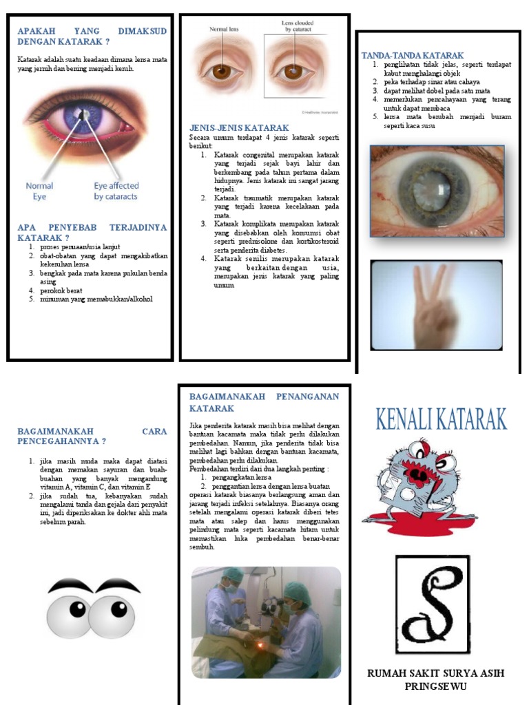 Leaflet Katarak | PDF