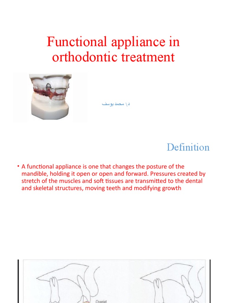 Functional Appliance in Orthodontic Treatment | PDF