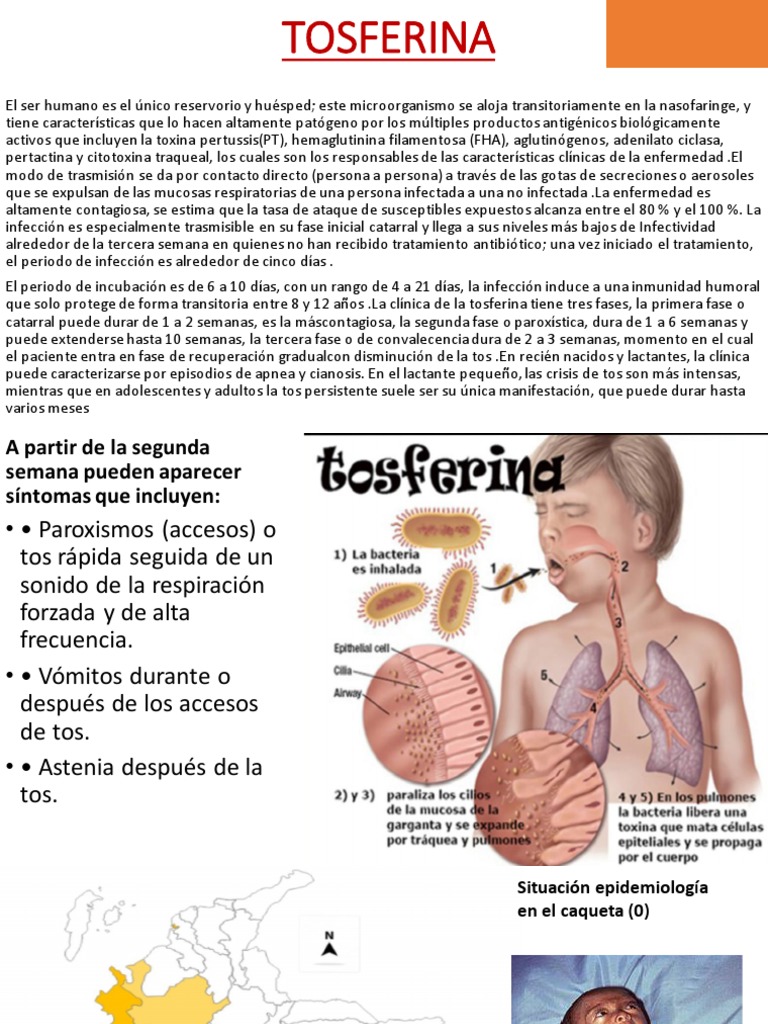 Tosferina | PDF | Especialidades Medicas | Medicina CLINICA