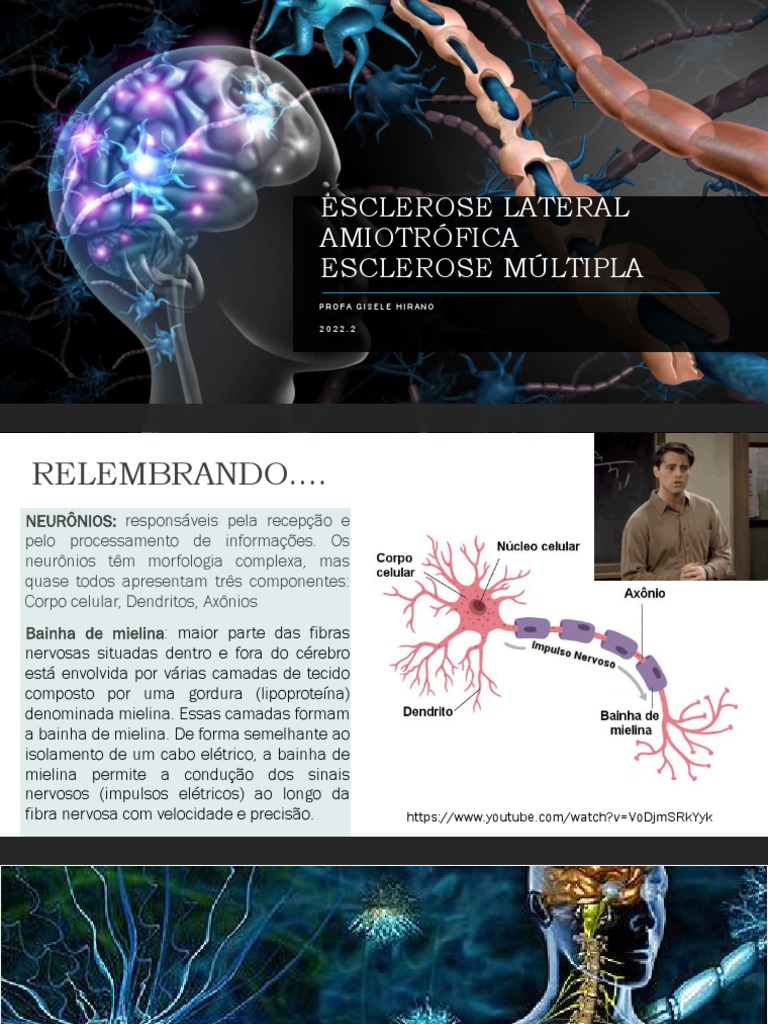 Esclerose Múltipla e Neurônios Motores | PDF | Mielina | Neurônio motor