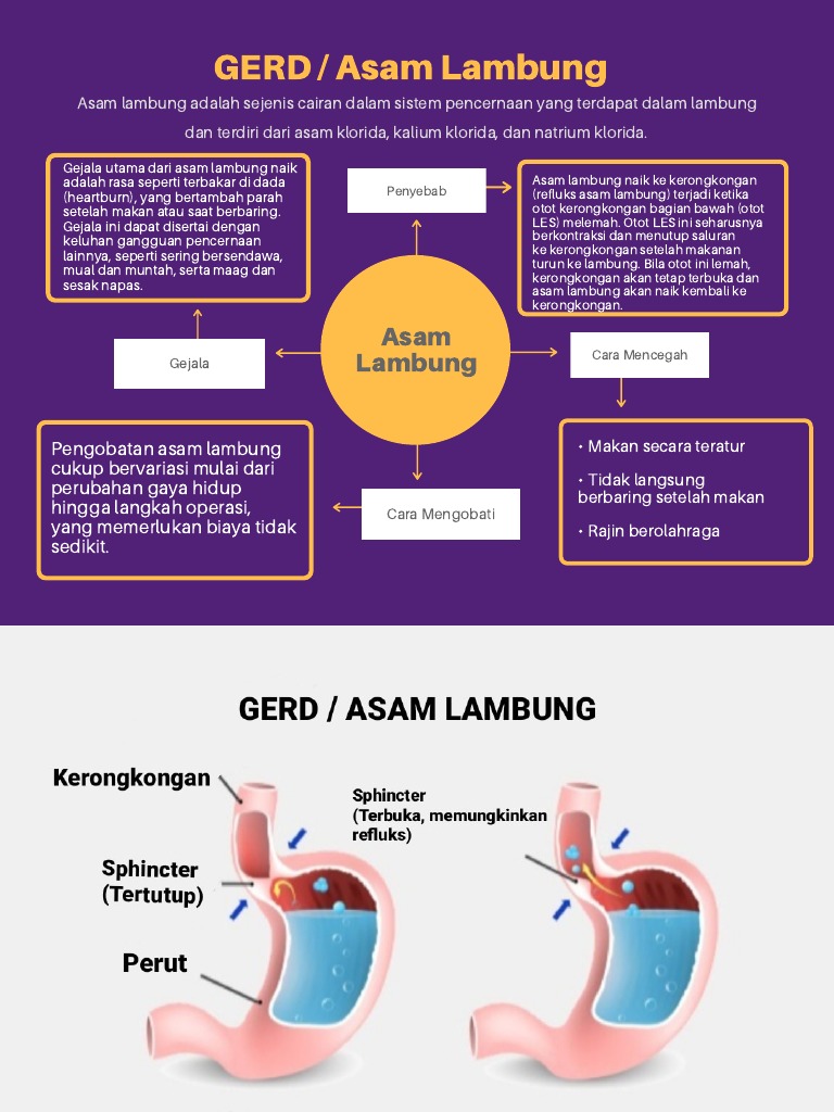 Mind Map GERD/Asam Lambung | PDF