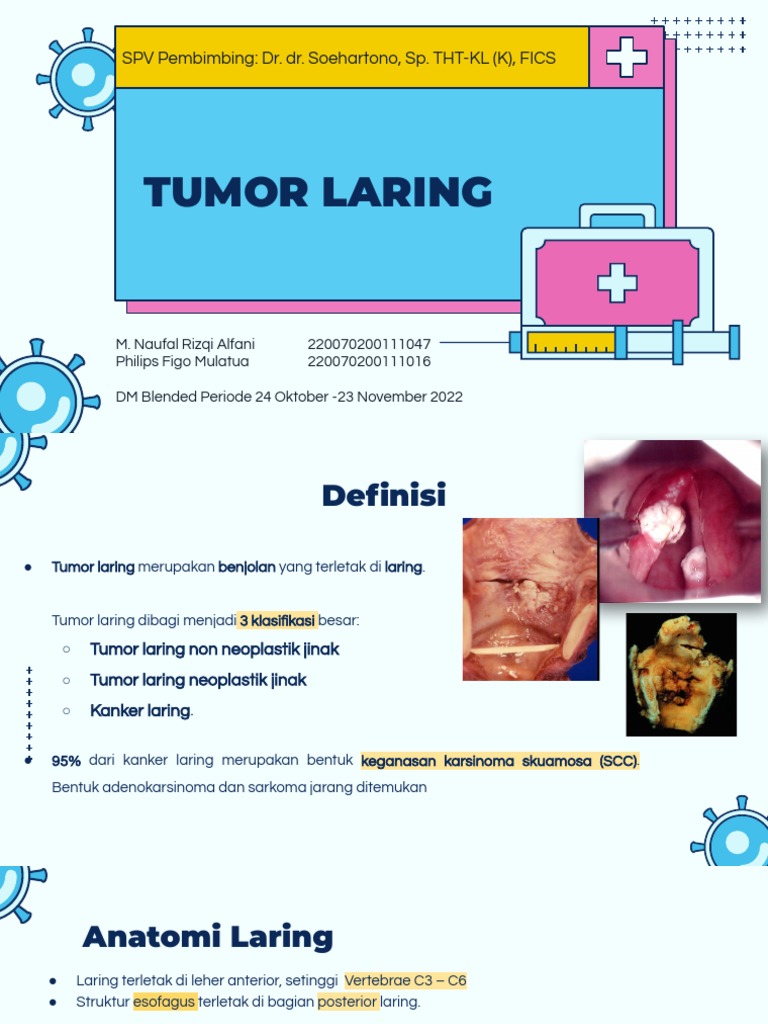 Tumor Laring | PDF