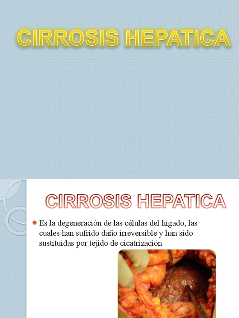 Cirrosis 2022 | PDF | Cirrosis | Hepatitis