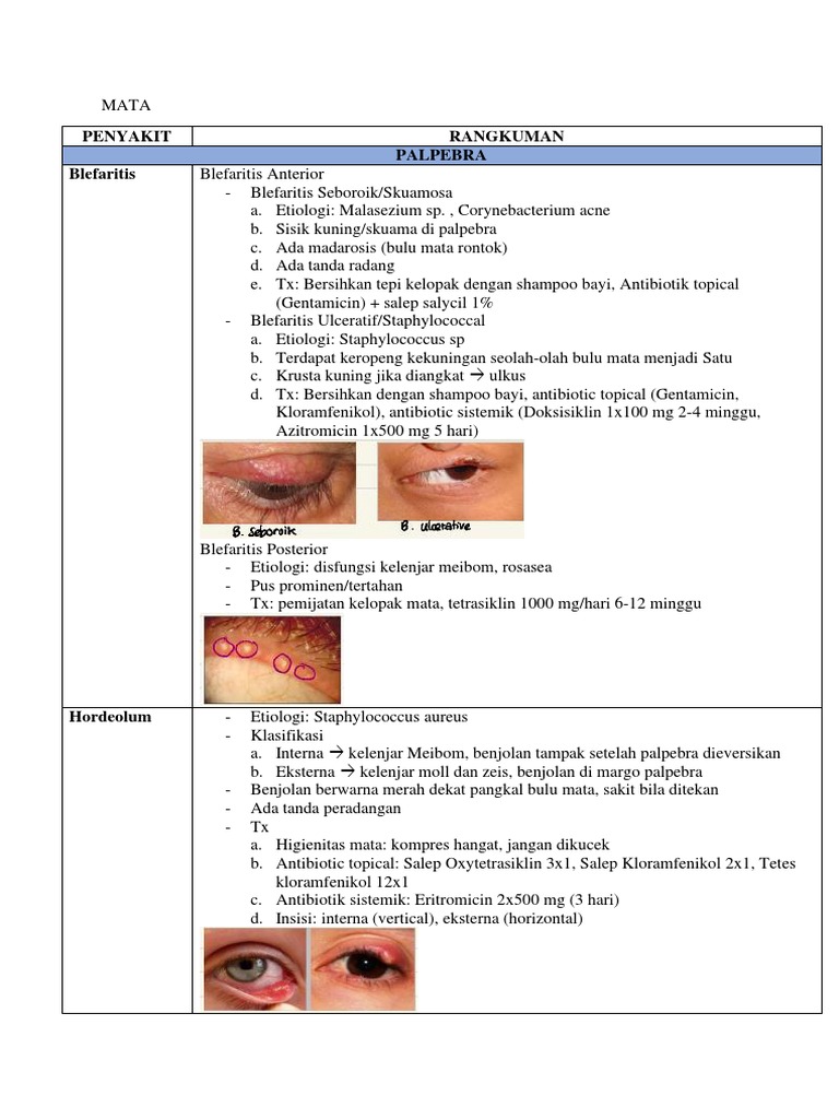 Rangkuman Penyakit Mata | PDF