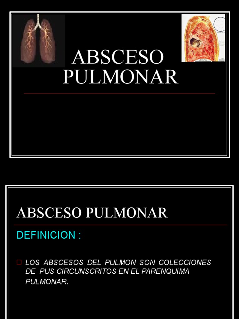 Absceso Pulmonar: Definición y Tratamiento | PDF | Pulmón ...