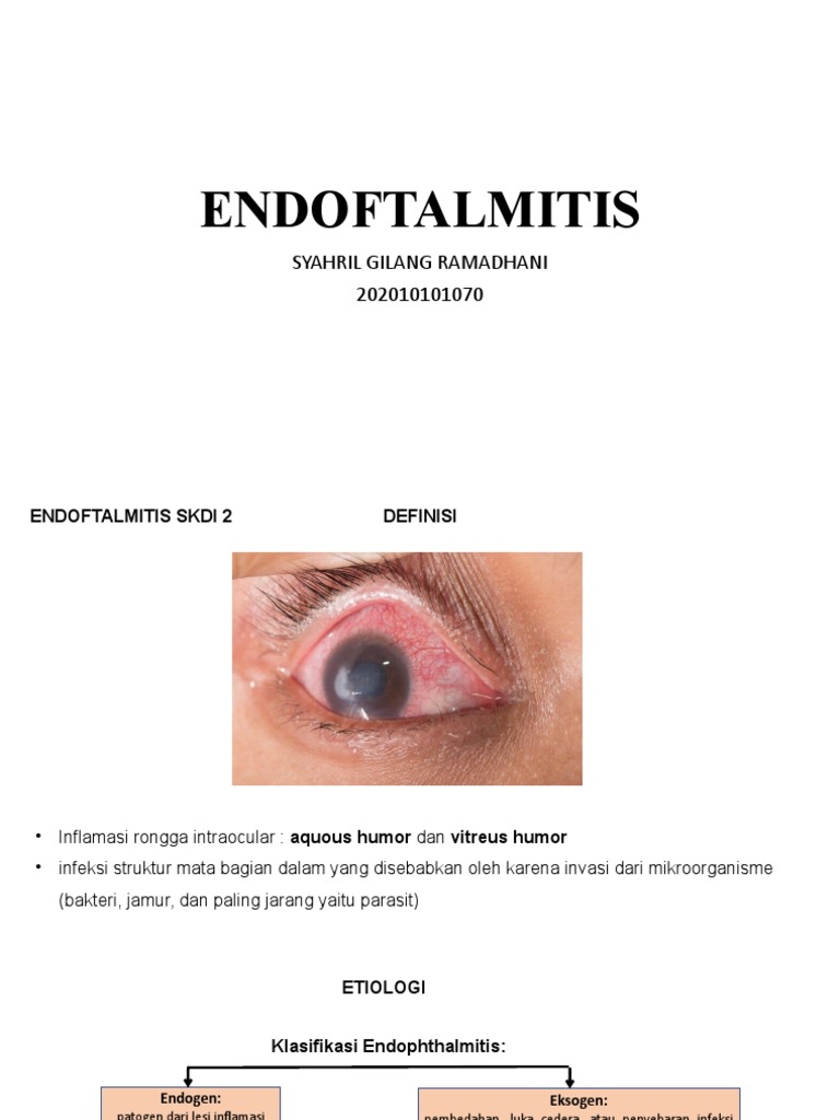 ENDOFTALMITIS | PDF