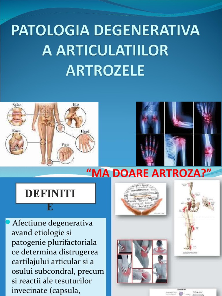 Lp1-Coxartroza Si Nacf | PDF