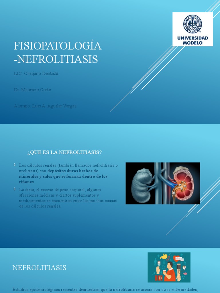 Fisiopatología de la nefrolitiasis: causas, síntomas y factores de ...