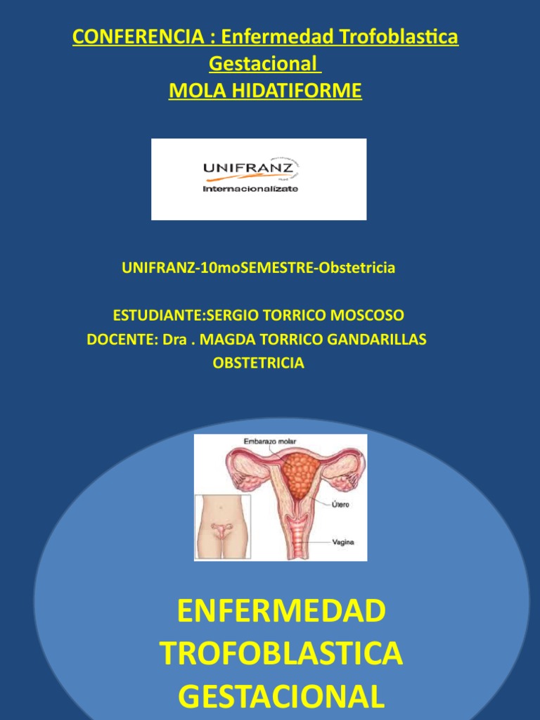 MOLA Hidatiforme | PDF | El embarazo | Placenta