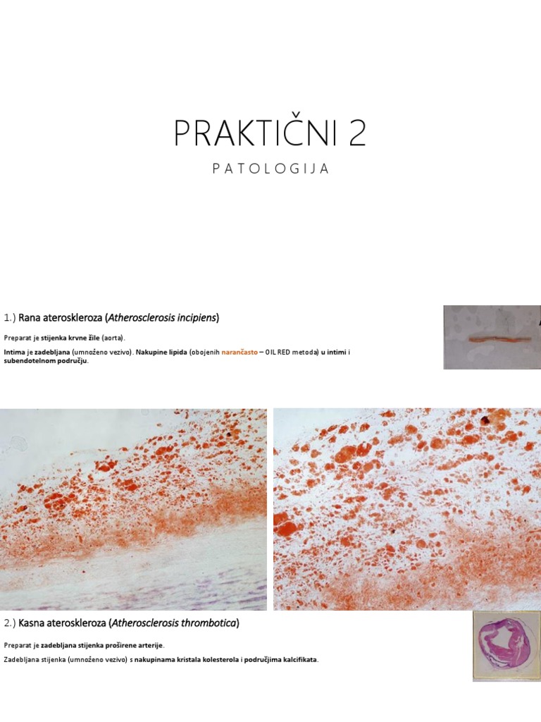 Patologija Praktični 2 | PDF