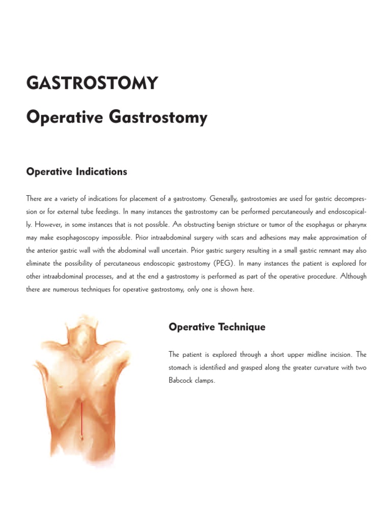 Atlas of Surgery Cameron Volume II. 2nd | PDF | Medicine | Gastroenterology