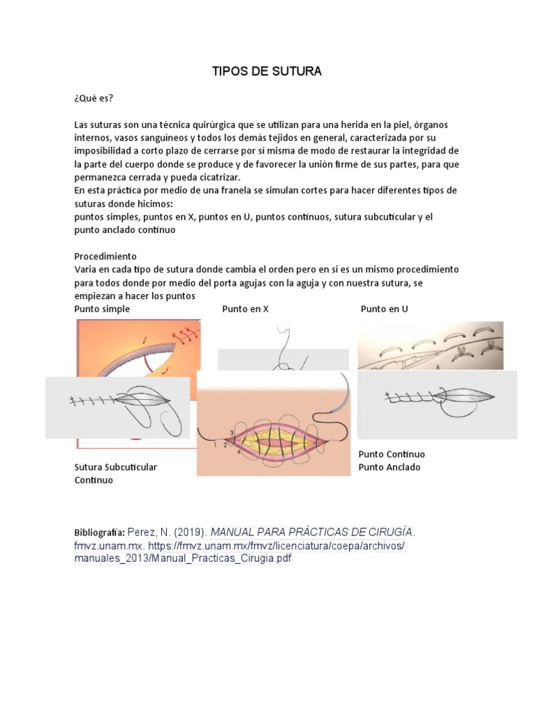 Tipos de Sutura | PDF