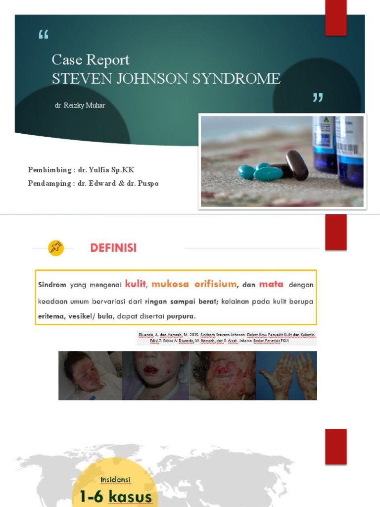 Steven Johnson Syndrome | PDF