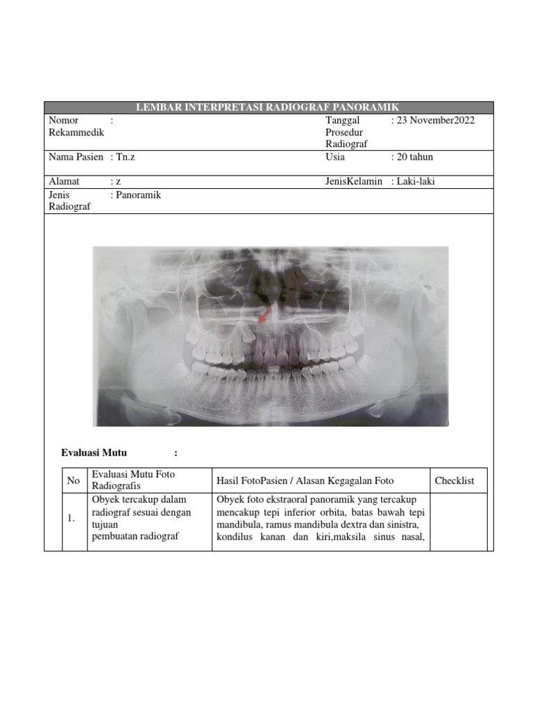 Panoramik Interpretasi | PDF