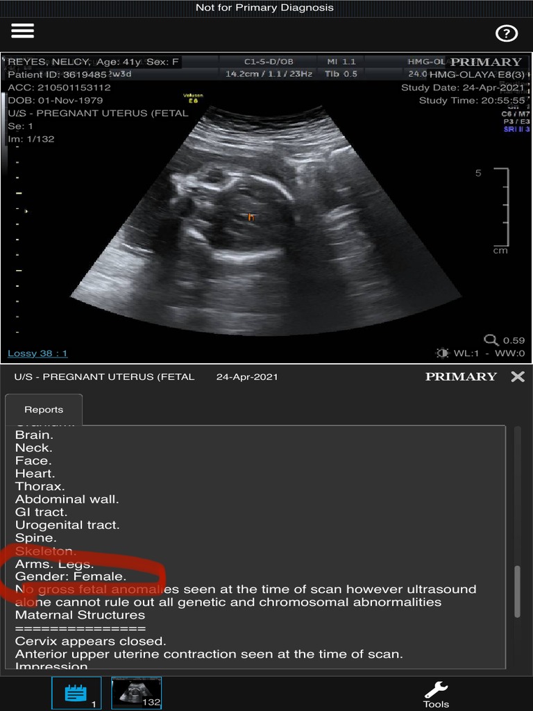 Universal Viewer Zero Footprint | PDF