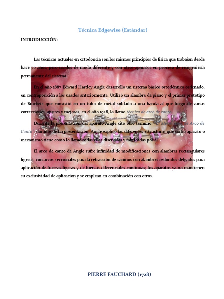 Técnica Edgewise (Standar) | PDF | Ortodoncia | Ramas de Odontología