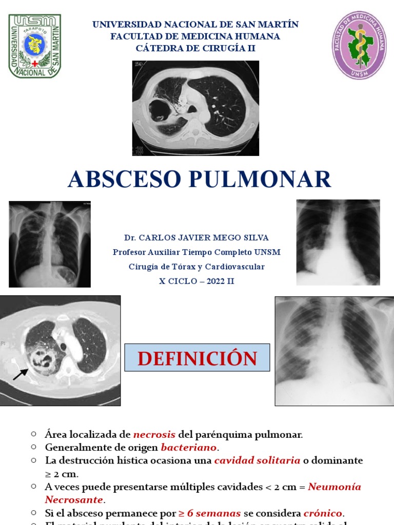 Absceso Pulmonar - Clase 1 | Descargar gratis PDF | Neumonía ...
