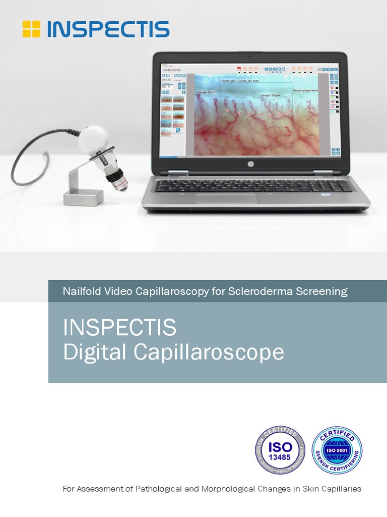 Catalog Capillaroscope | PDF | Databases | Medical Diagnosis