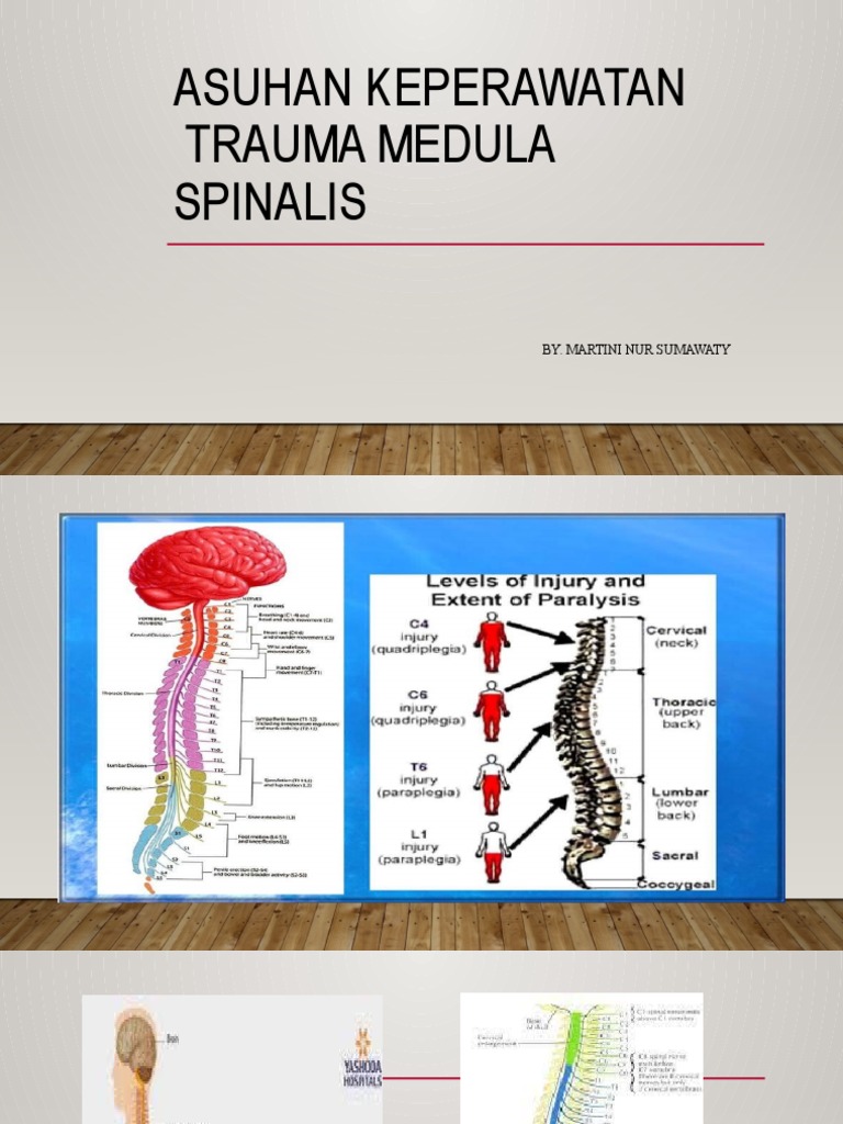 Askep Trauma Medula Spinalis | PDF