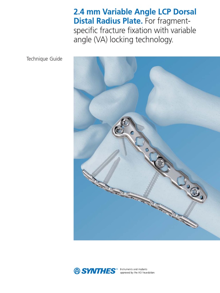 Dorsal Distal Radius Variable Angle | PDF | Screw | Musculoskeletal System