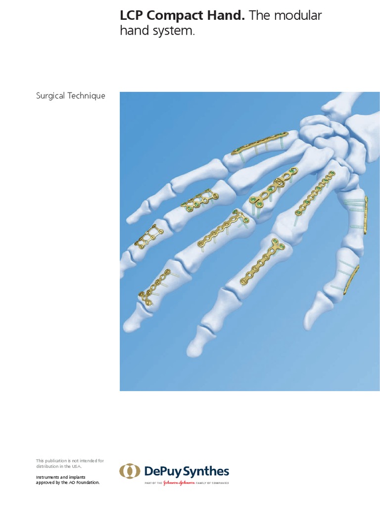 Hand Plates 1.5 2 2.4 Synthes | PDF | Drill | Magnetic Resonance Imaging