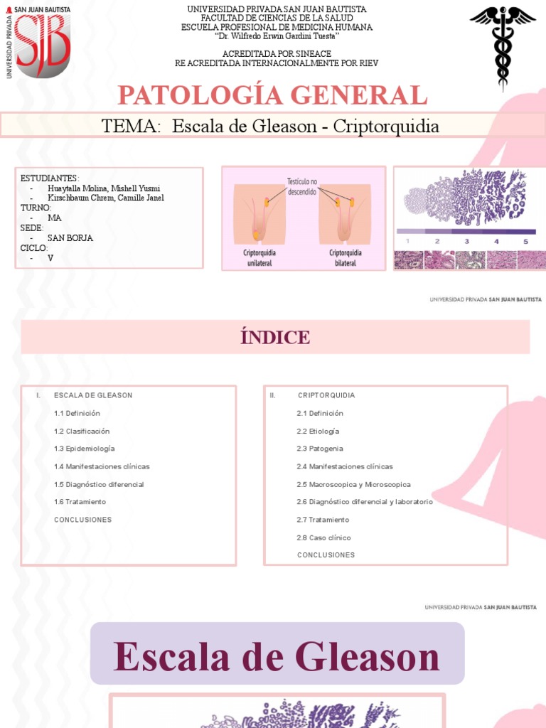 Criptorquidia - Escala de Gleason | PDF | Cancer de prostata ...