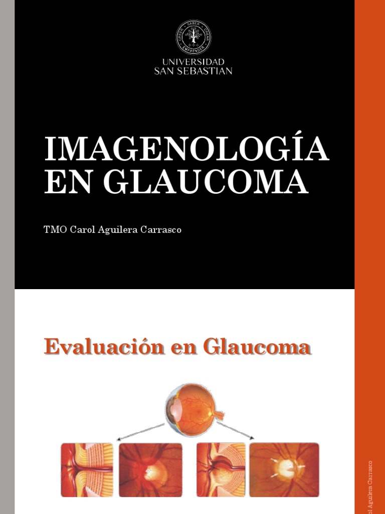 Clase 11 - Imagenología en Glaucoma (HRT y GDX) | PDF