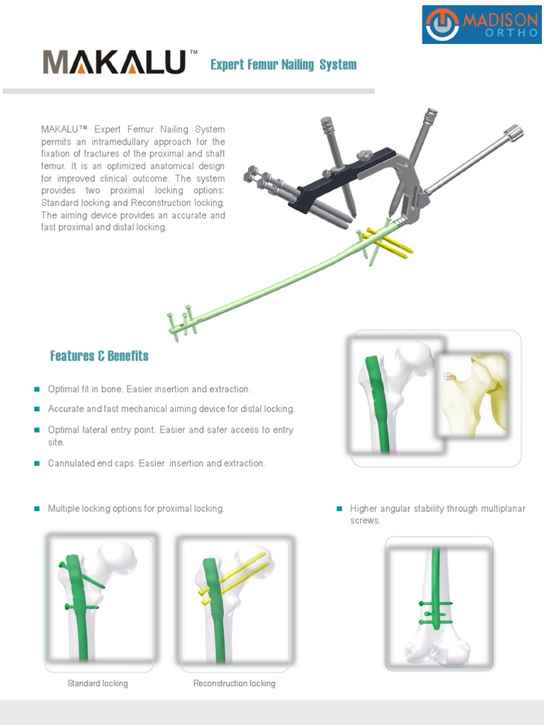 Expert Femur Nailing System - Madison Ortho | PDF | Drill | Screw